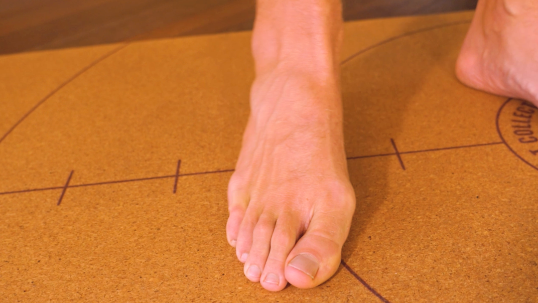 Bunions Explained: What They Are and What You Can Do About Them – The ...